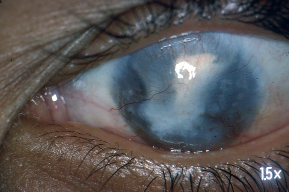 Index of /wp-content/uploads/sites/17/2018/07